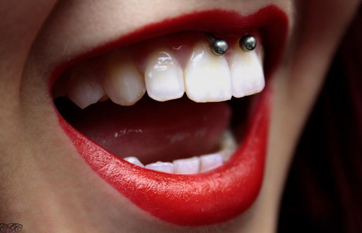 Smiley Piercing: A Comprehensive Guide to This Oral Piercing - Rebel Bod